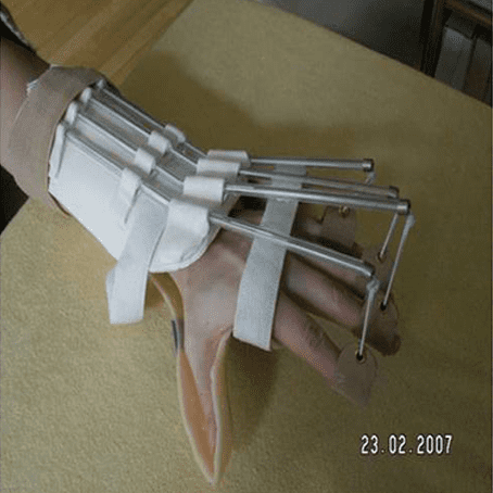 #Top Knee Pain Specialist in Mumbai - Pro-Ortho Perfect India - Best ...